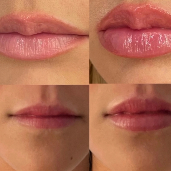 BEAMBO | Skincare | Nib Beambo The Lip Gizmo Lip Plumping Device Tik ...